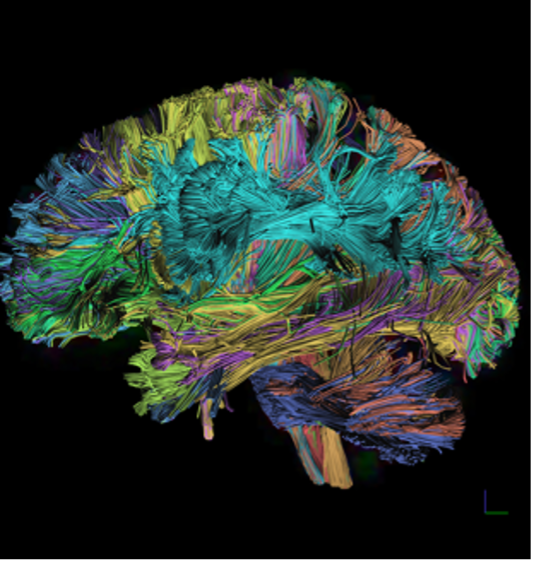 Biomedical Imaging - School of EngineeringSchool of Engineering ...