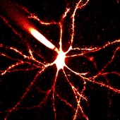 Neural Engineering - School of EngineeringSchool of Engineering ...